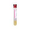 BD Vacutainer SST Venous Blood Collection Tube, Tiger Top, 8.5mL Draw ...