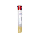 BD Vacutainer SST Venous Blood Collection Tube, Tiger Top, 8.5mL Draw ...